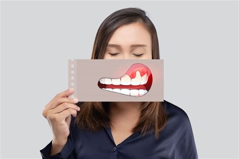 Common Types Of Gum Diseases Dental Implant Solutions