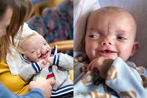 Chirurgie bébé mal formé