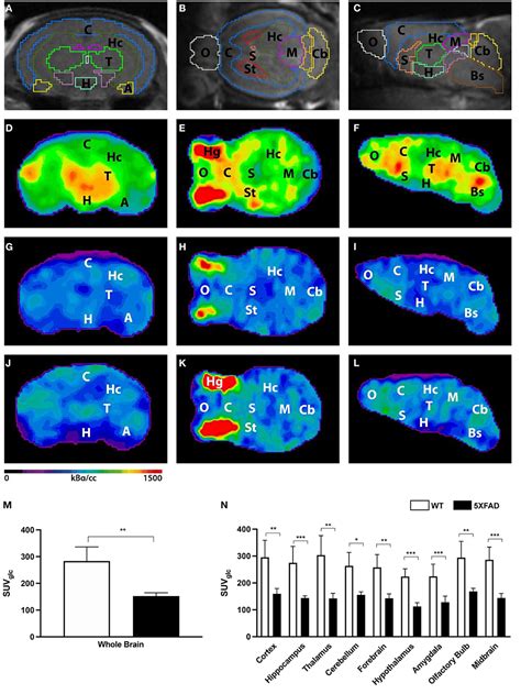 Frontiers Quantitative Brain Positron Emission Tomography In Female