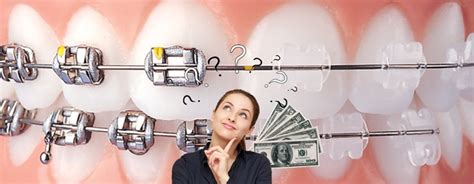 Cuál es el COSTO de los Brackets 2022 Solución Dental 2022