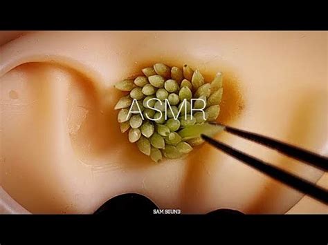 ASMR 긴데 뾰족한 귀지가 겁나 많다 이건 못참지 시각적 팅글 뿜뿜하는 긴 귀지 제거 귀청소 팅글보장 No