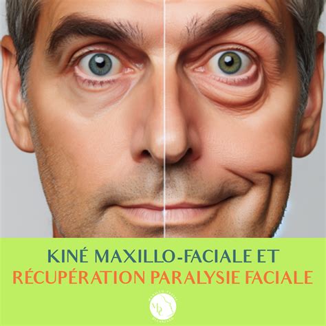 Surmonter la paralysie faciale avec la rééducation maxillo faciale