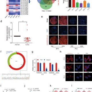 Hsa Circ 0063329 Was Downregulated In PCa Cells And Tissues A