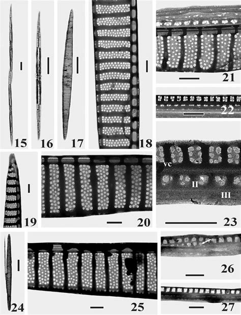 Pseudo Nitzschia Multiseries Field Samples And Culture Material From