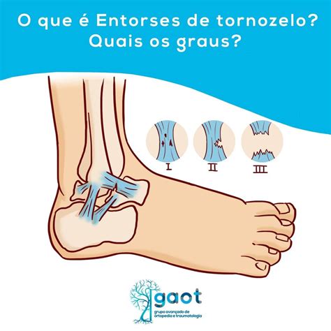 O que é Entorses de tornozelo GAOT
