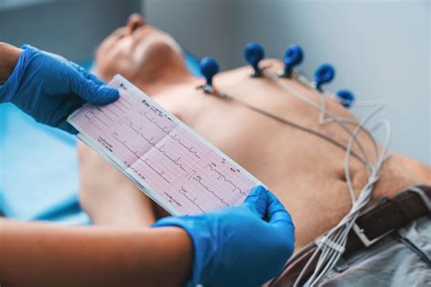 Electrocardiograma y ACV la influencia de la hipertensión NeuroAiD