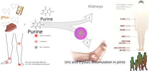What Is Normal Range For Uric Acid Blood Test