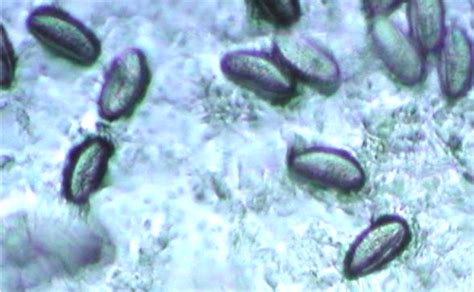 J Parasitology Flashcards Quizlet
