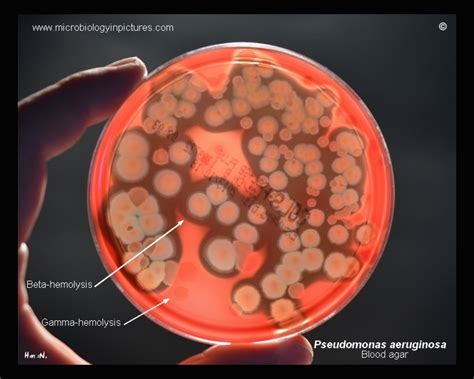 Beta Hemolysis On Blood Agar Cloudshareinfo