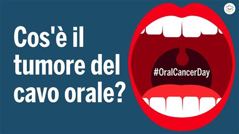 Cos è il carcinoma del cavo orale PREVENZIONE del tumore alla BOCCA