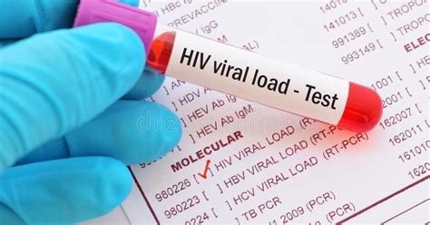 Our Goal Undetectable Viral Load Living With HIV In The Philippines