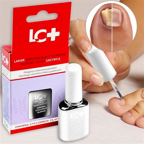 Lc Lakier Preparat Na Grzybicę Grzybica Paznokci Ochrona 12Ml Opinie