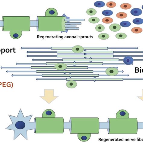 Schematic Demonstration Of Superior Nerve Regeneration With Special
