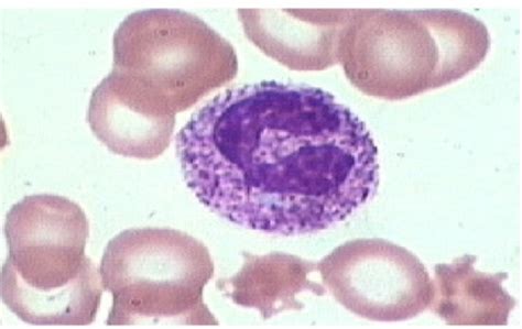 Clin Lab Wbc Disorders Flashcards Quizlet