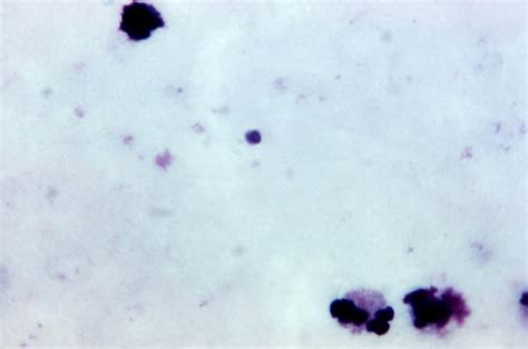 Free Picture Thick Blood Smear Photomicrograph Comma Shaped