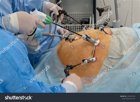 Laparoscopy Hands Doctors Using Laparoscopic Instruments Stock Photo