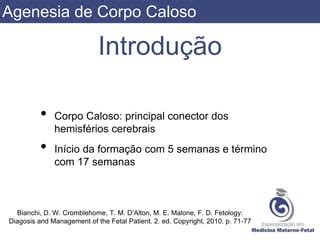 Hemisf Rios Cerebrais E Corpo Caloso