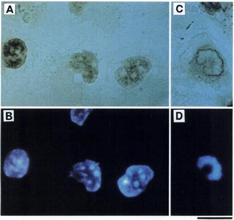 Double Staining Of Proteasomes And DNA In A704 Cells Proteasomes Were