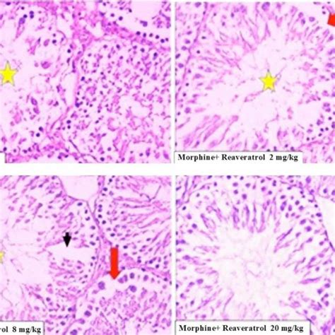 Resveratrol And Morphine Effect On Morphology Of Seminiferous Tubules