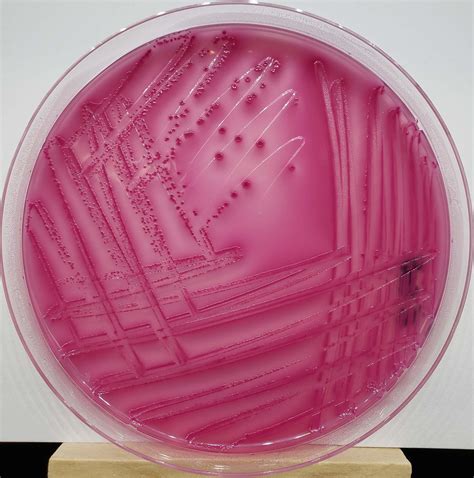 E Coli On MacConkey Agar A Photo On Flickriver