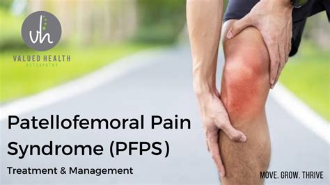 Patellofemoral Pain Syndrome PFPS Valued Health Osteopathy
