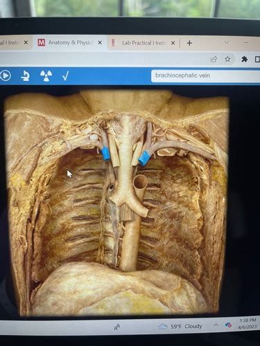 Veins Superior Vena Cava Flashcards Quizlet