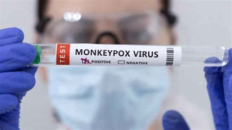 La OMS declara la viruela símica como una emergencia sanitaria mundial