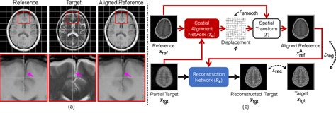 figure 1 from multimodal mri reconstruction assisted with spatial alignment network semantic