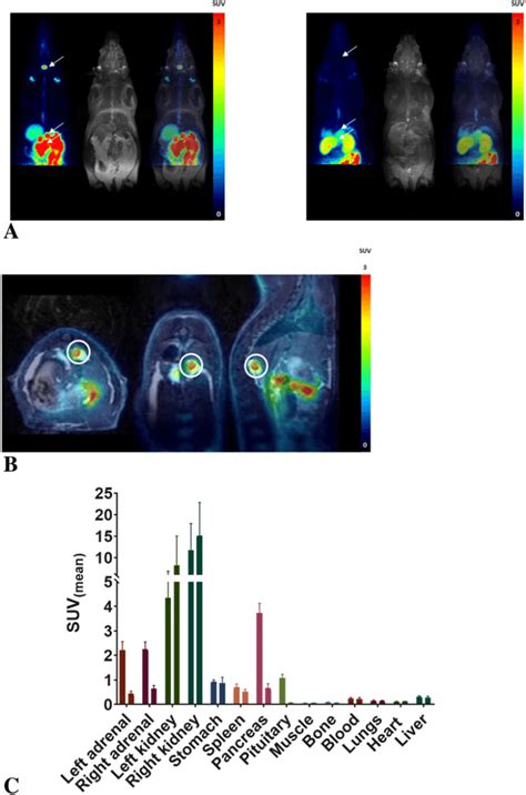 Example Of Multimodality PET MRI Imaging Providing Several Advantages