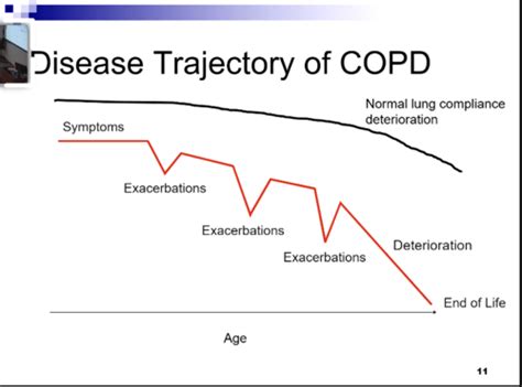 Copd Flashcards Quizlet