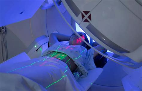 Does Radiation Therapy Cause Hair Loss Here S The Truth
