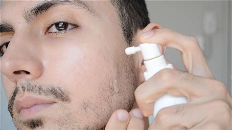 Minoxidil Que Es Para Que Sirve Y Como Aplicar Barba Kulturaupice The