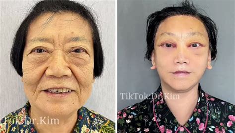 Dr Kim El cirujano que causa terror en TikTok por las cirugías