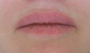 Why Is The Area Around My Lips White Lipstutorial Org