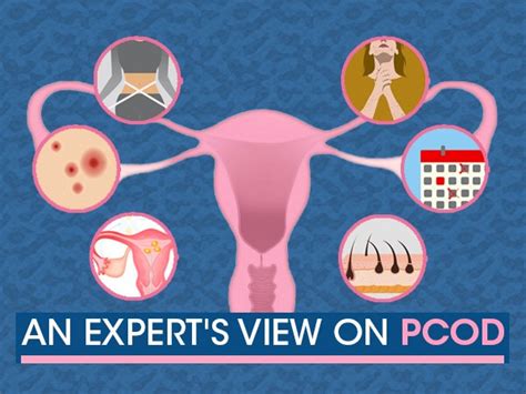 What Is Polycystic Ovary Disease PCOD Causes Symptoms Diagnosis