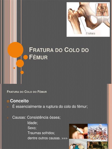Pdf Fratura Do Colo Do F Mur Pdfslide Net