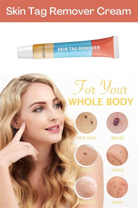 Skin Tag Remover Warts Mole Remover Cream Quickly And Easily Remove