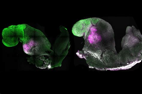 Synthetic Mouse Embryos Grown From Stem Cells Have A Brain And Beating