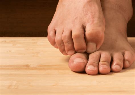 Hallux Limitus Foot Mechanics