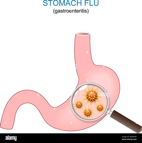 Stomach Flu Human Stomach Isolated On White Background Close Up Of