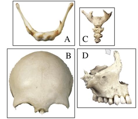 Bones Diagram Quizlet