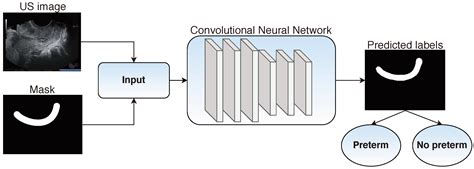 electronics free full text machine learning methods for preterm birth prediction a review
