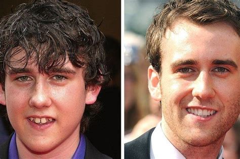 Black Celebrities With Bad Teeth Before And After