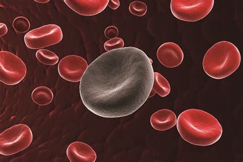 Cuidado Esses sintomas indicam que você está leucemia Diario ao Vivo