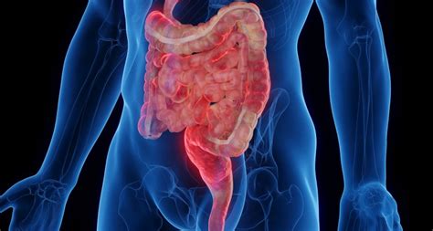 Morbus Crohn Und Colitis Ulcerosa Antibiotika Und Westliche Toiletten