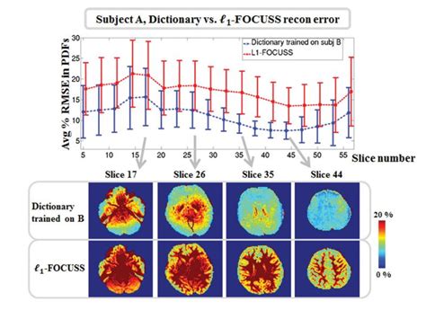 nuit blanche accelerated dsi with compressed sensing using adaptive dictionaries implementation