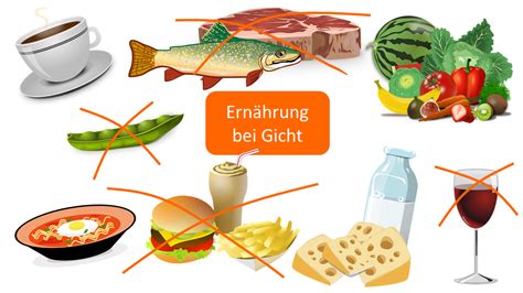 Gicht Ihre Apotheke informiert über Krankheiten