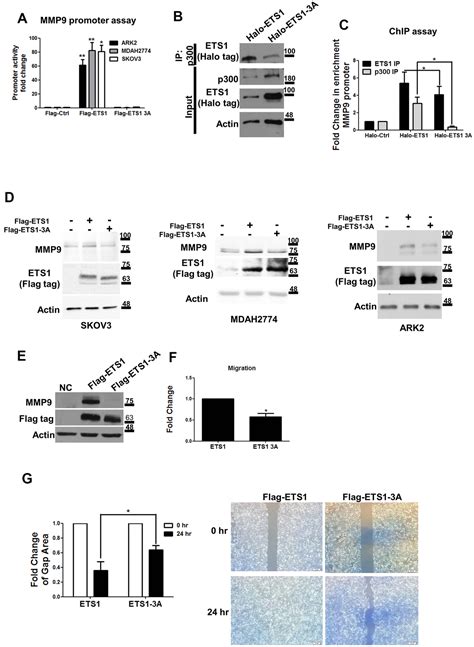 Aging Glycogen synthase kinase 3 beta GSK3β mediated