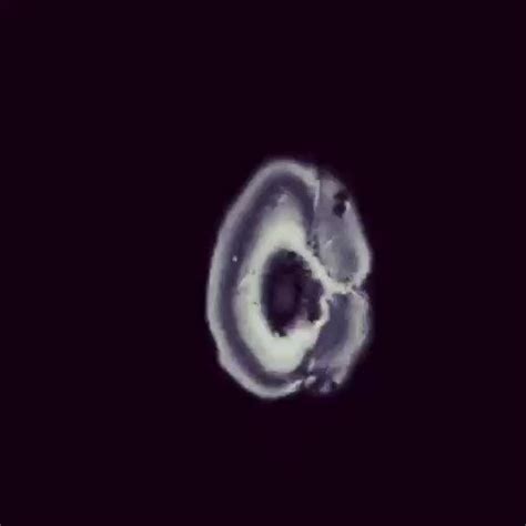 The Innovation Medicine On Twitter RT Innov Medicine Brain MRI