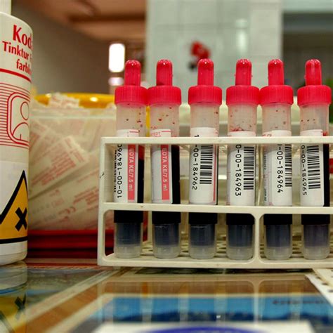 Cómo interpretar un análisis de sangre 4 pasos